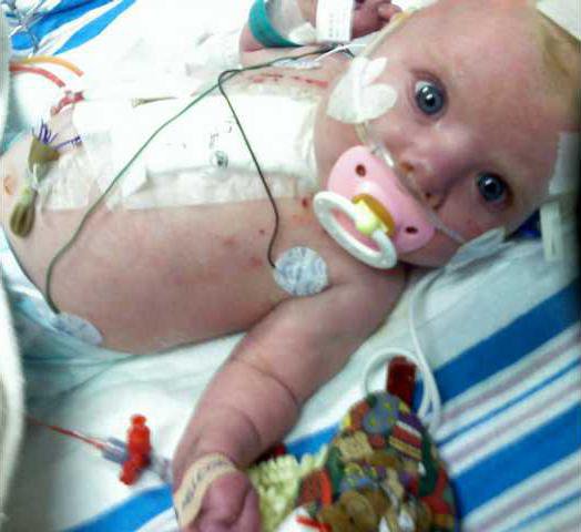 Congenital Heart Defect Awareness Week education effort underway ...