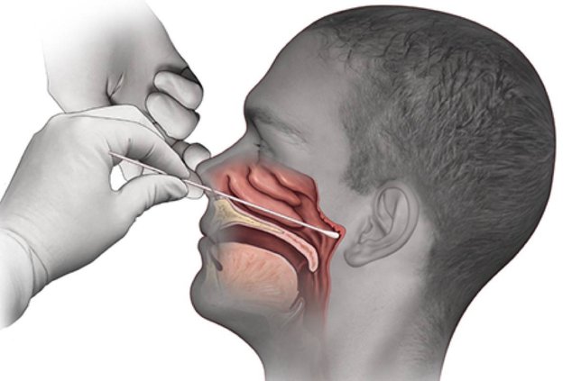 TESTED FOR COVID-19 - Manteca Bulletin